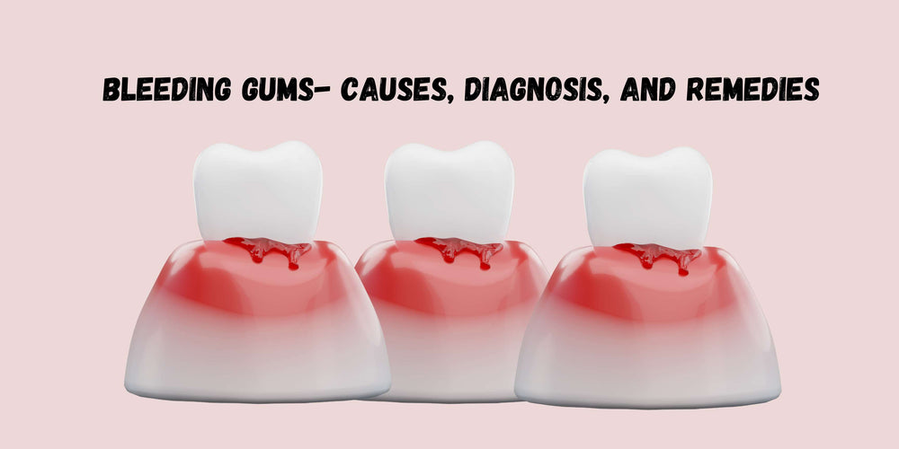 Bleeding Gums- Causes, Diagnosis, and Remedies - PUREXA Oral Care